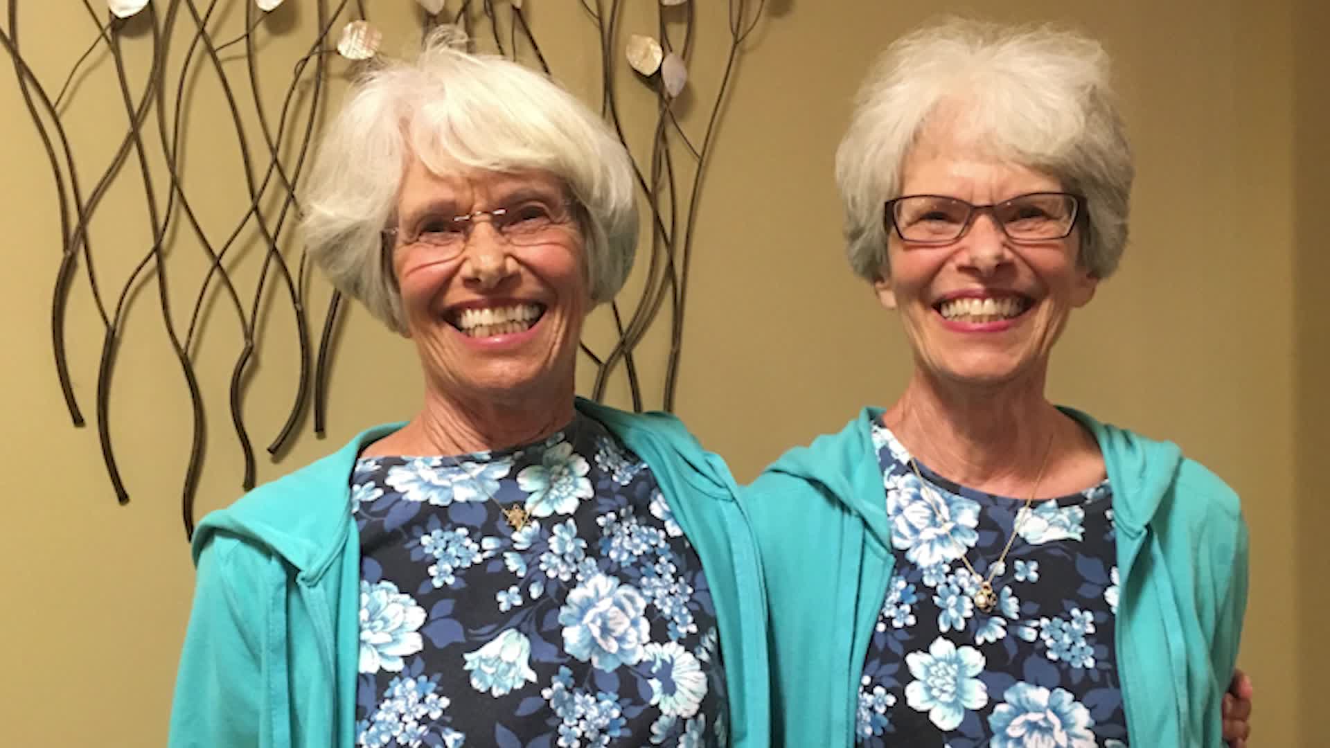 Twins show effects of sun, smoking, stress on aging – PIX11